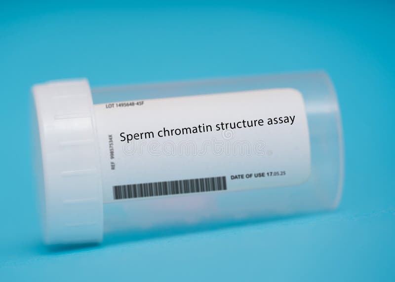 Sperm Chromatin Structure Assay Stock Image - Image of assay, structure ...