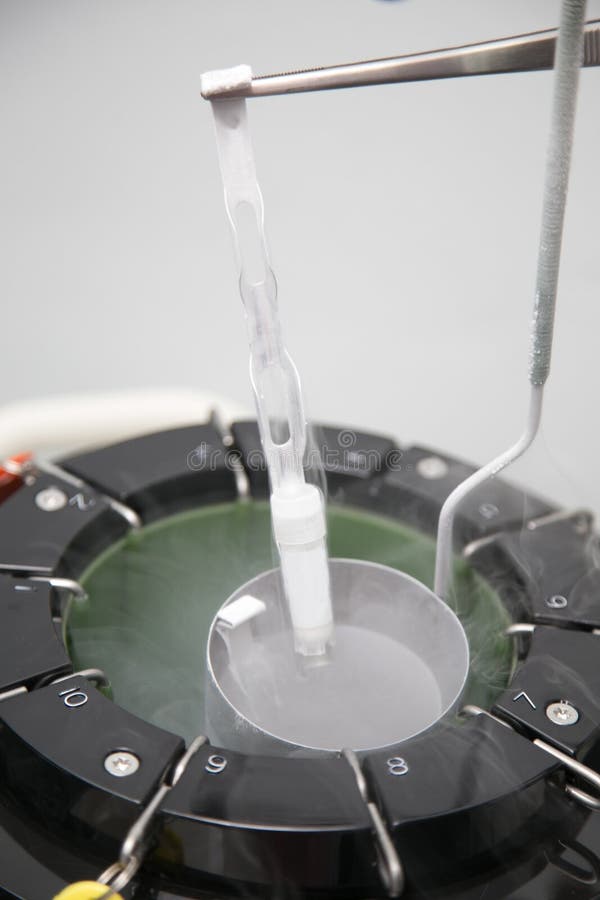 Sperm Freezing Storage in Liquid Nitrogen Tank, Laboratory Infertility ...