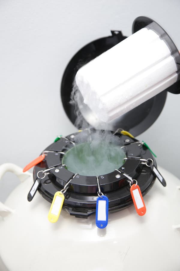 Sperm Freezing Storage in Liquid Nitrogen Tank, Laboratory Infertility ...