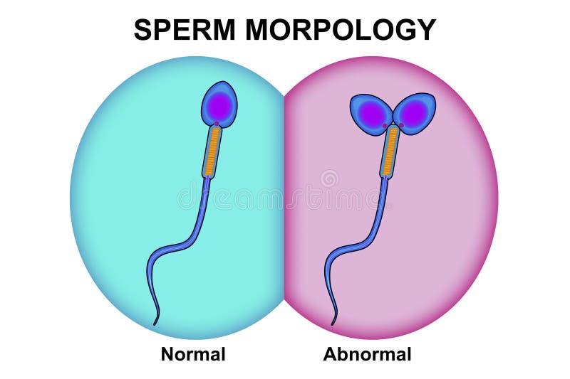 Sperm Morphology Comparison between Normal and Abnormal Stock ...
