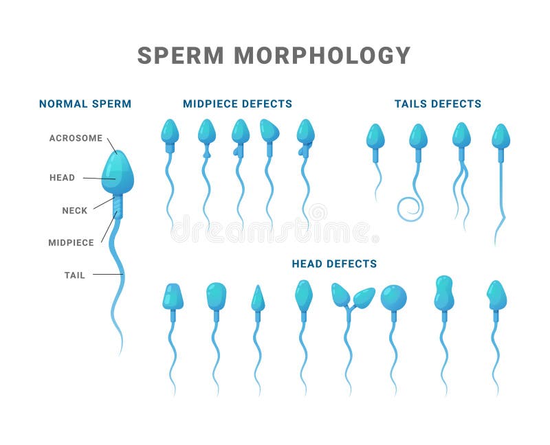 Sperm Morphology Count Type Educational Medical Scheme Vector Flat ...