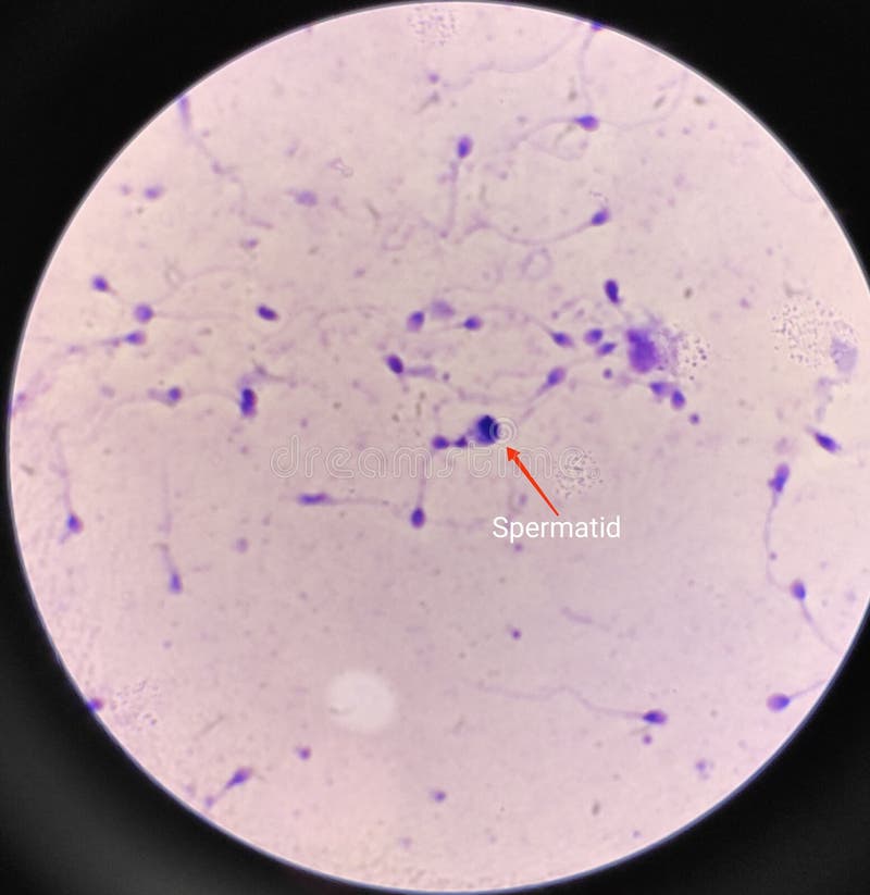 Spermatid in Sperm Analyzer Stock Image - Image of plasme, cell: 261931551