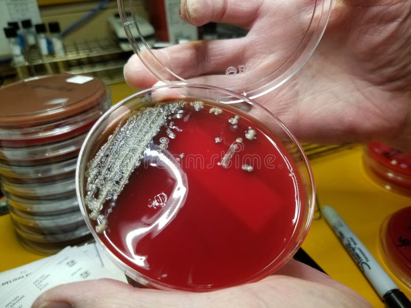 Sphingomonas Bacterial Stock Photos - Free & Royalty-Free Stock Photos ...