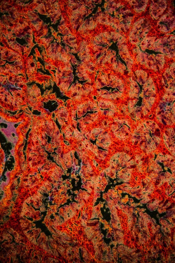 Spider Gland with Garden Cross Spider Stock Image - Image of histology ...