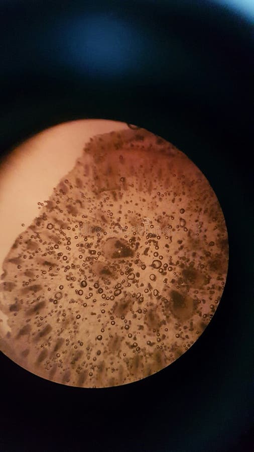 434 Eye Under Microscope Stock Photos - Free & Royalty-Free Stock ...