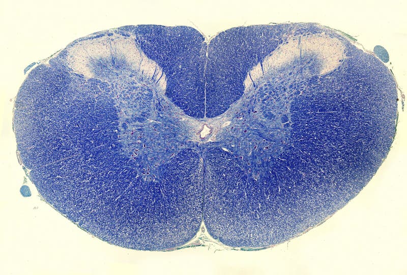 Spinal Cord. Luxol Fast Blue Stain Stock Image - Image of fiber, grey ...