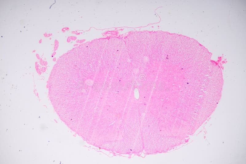 Spinal Cord and Motor Neuron Under the Microscope. Stock Photo - Image ...