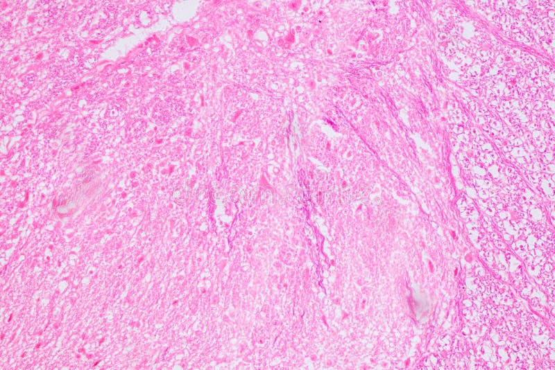 Spinal Cord and Motor Neuron Under the Microscope. Stock Photo - Image ...