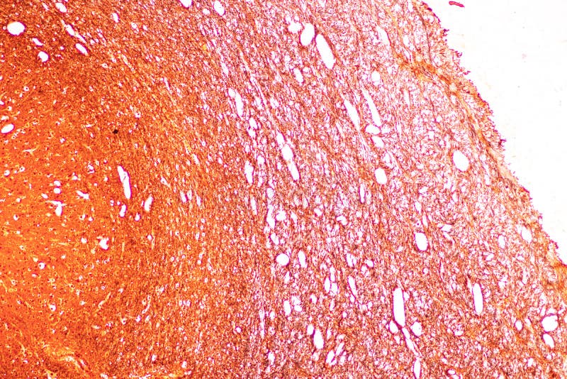 Spinal Cord, Nerve, Cerebellum, Cortex and Motor Neuron Human Under the ...