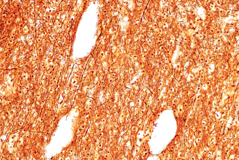Spinal Cord, Nerve, Cerebellum, Cortex and Motor Neuron Human Under the ...