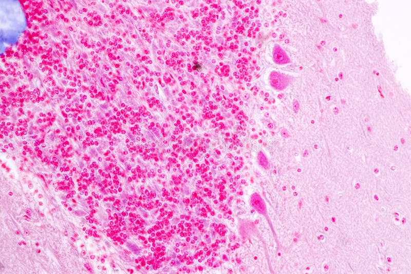 Spinal Cord, Nerve, Cerebellum, Cortex and Motor Neuron Human Under the ...