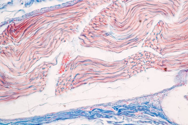 Spinal Cord, Nerve, Cerebellum, Cortex and Motor Neuron Human Under the ...