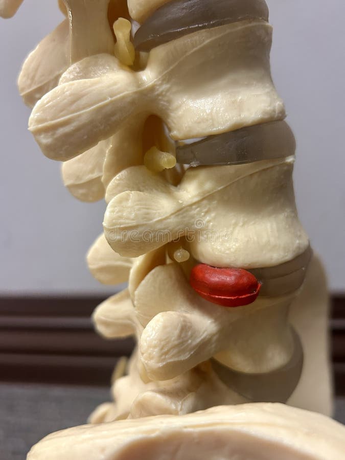 Chiropractic Lobby Art Stock Photos - Free & Royalty-Free Stock Photos ...