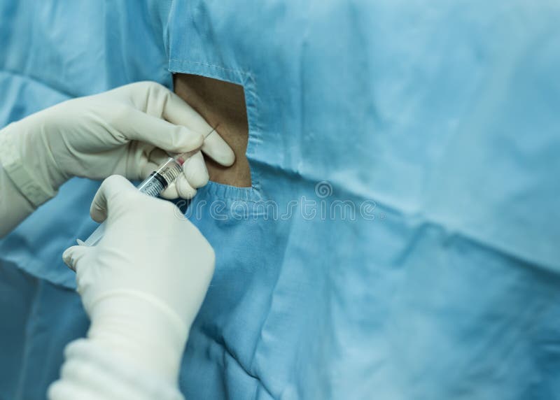 Spinal nerve block stock photo. Image of hand, paraplegia - 56160008