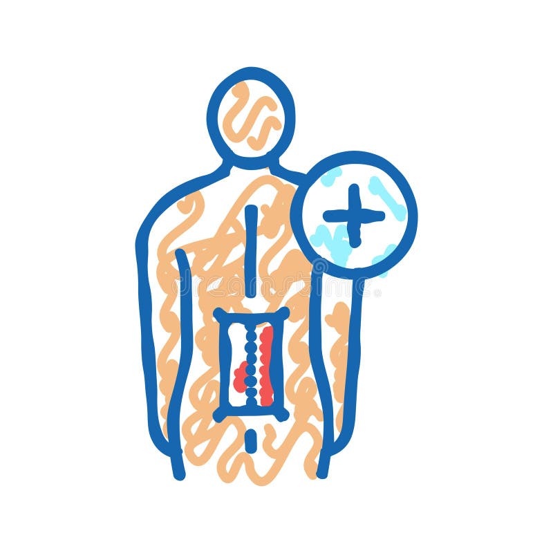 Spinal Surgery Icon Doodle Illustration Stock Illustration ...