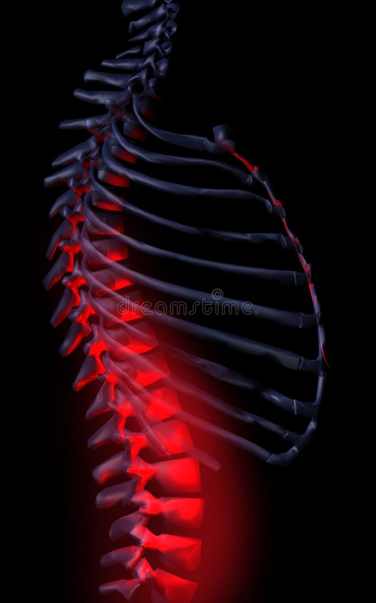 Flank Pain Stock Illustrations – 51 Flank Pain Stock Illustrations ...