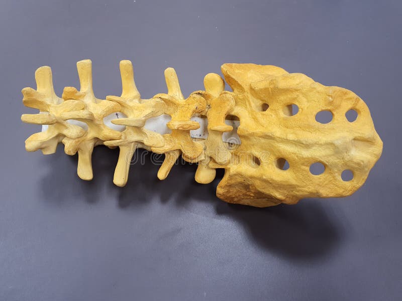 Spine Model. Neurosurgeon. Medical Concept. Backpain Stock Photo ...