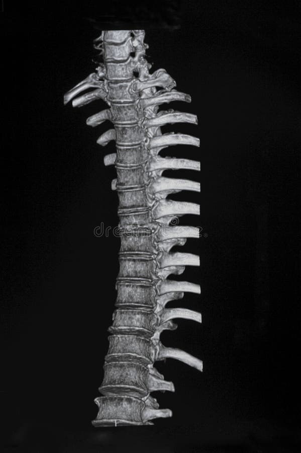 Spinal mri images stock illustration. Illustration of care - 373747981
