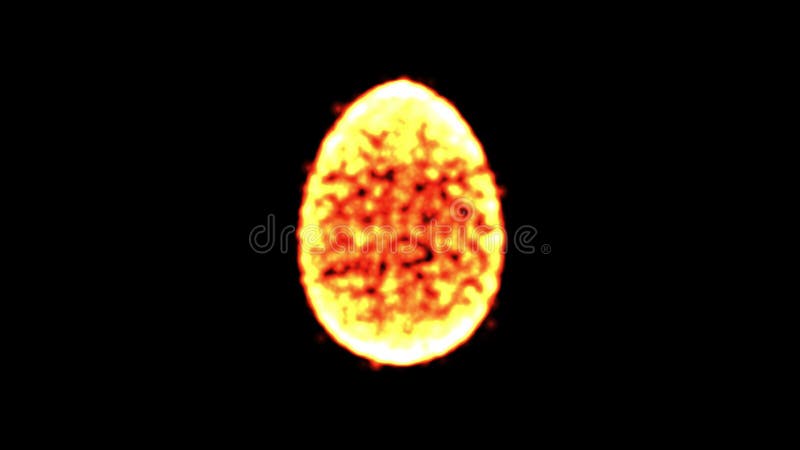 Spinning 3d Fire Egg Motion Graphics with Plain Black Background Stock ...