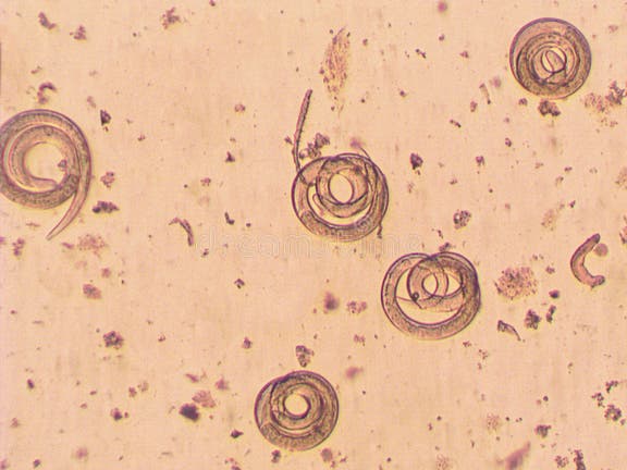 Spiralis De Trichine - Microscope De Ver Parasite Photo stock - Image ...