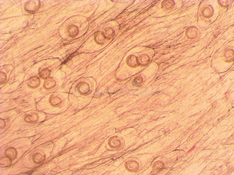 Spiralis De Trichine - Microscope De Ver Parasite Image stock - Image ...