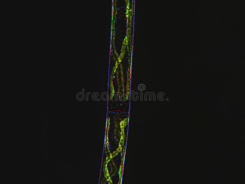 Spirogyra Sp. Green Algae Under Microscopic View X40 - Chlorophyta ...