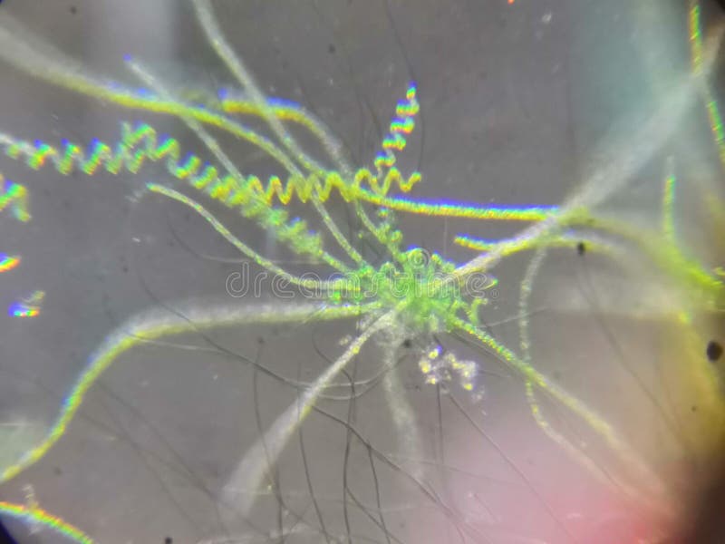 Spirulina Under the Microscope Stock Image - Image of biology, nature ...