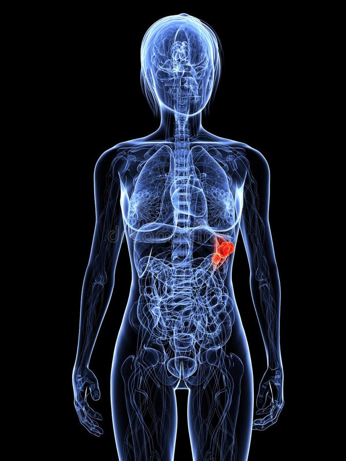 Inflamed spleen stock illustration. Illustration of diagnostic - 10245782