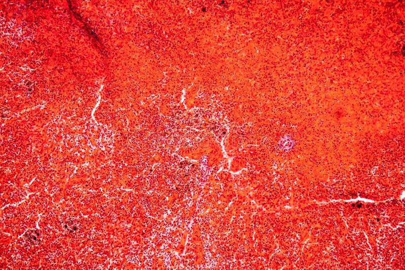 Spleen tissue stock image. Image of nucleus, science - 196730979