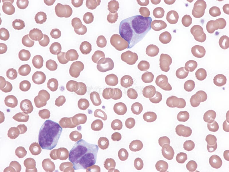 Binucleated Lymphocyte Stock Illustrations – 3 Binucleated Lymphocyte ...