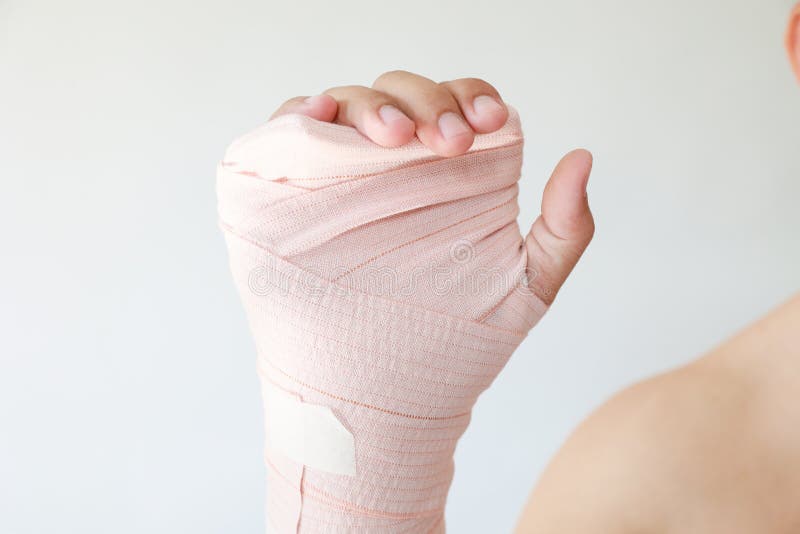 Splint and Bandages Wrist because of Injury Stock Photo - Image of ...