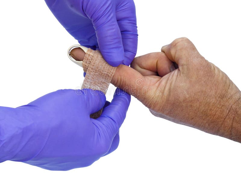 Splint do dedo imagem de stock. Imagem de médico, aplique - 21759147