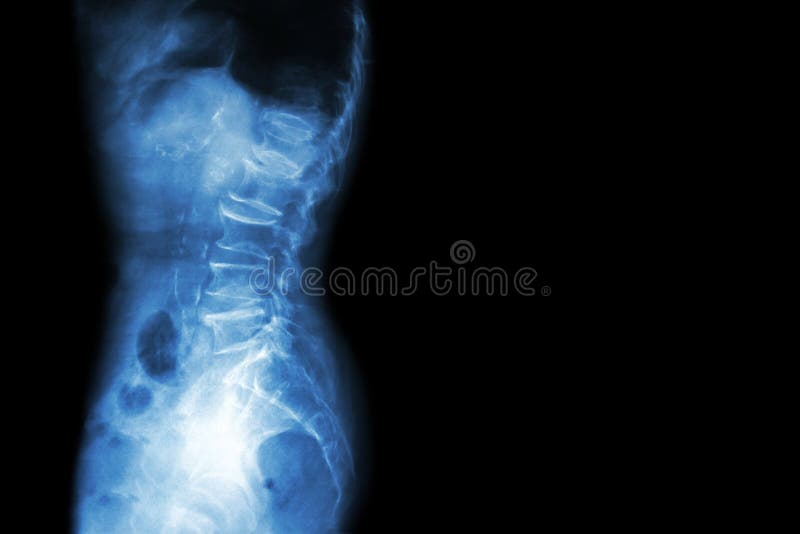 Osteopenia Right Stock Photos - Free & Royalty-Free Stock Photos from ...