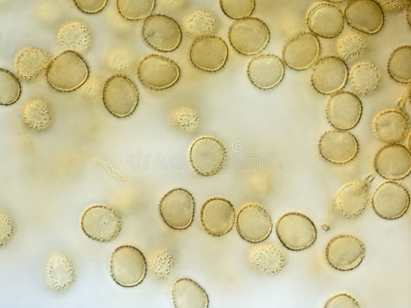 Spore Di Una Muffa Di Melma Microscopia Immagine Stock - Immagine di ...