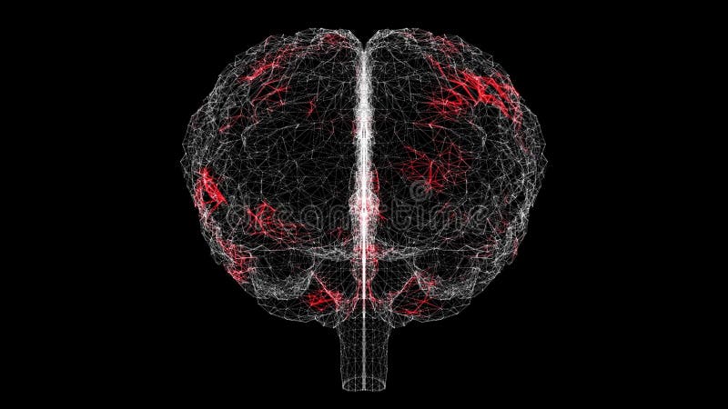 Spread of Virus through 3D Human Brain on Black Background. Visual ...