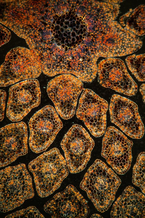 Spruce Needle in Cross Section Stock Photo - Image of enlarged, growth ...