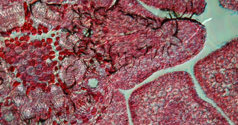 Spruce Shoot Tip with Pine Needles Cross-section Stock Video - Video of ...