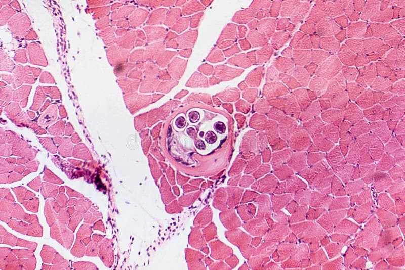 Trichine Spiralis Larven Im Muskelgewebe Unter Dem Mikroskop Stockfoto ...