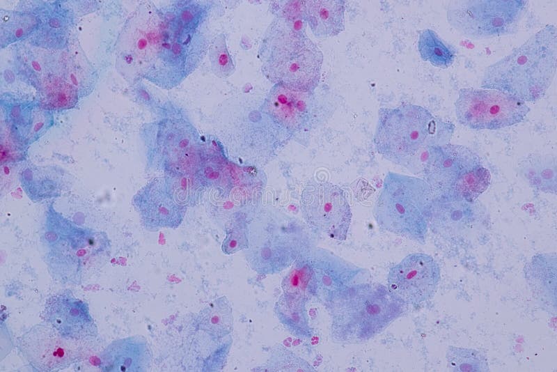 291 Basal Cell Microscope Stock Photos - Free & Royalty-Free Stock ...