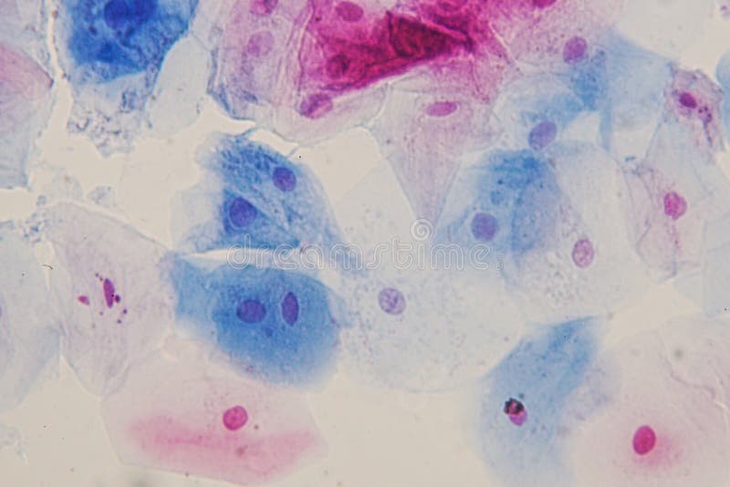 Squamous Epithelial Cells Under Microscope View for Education Hi Stock ...