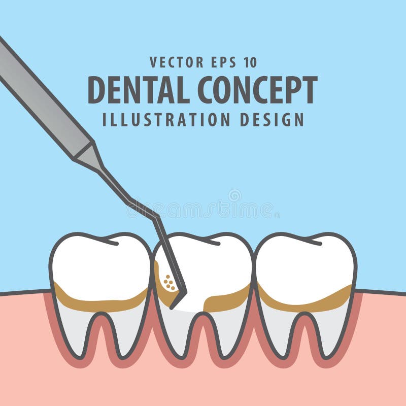 Layout Scaling Teeth Illustration Vector on Blue Background. Den Stock ...