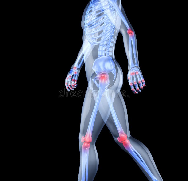 Squelette De L'homme Avec Le Mal De Dos Illustration Stock ...