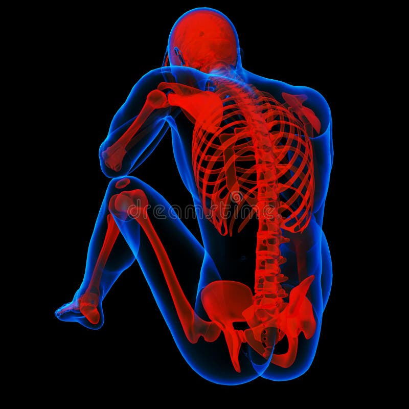 Squelette De L'homme Avec Le Mal De Dos Illustration Stock ...