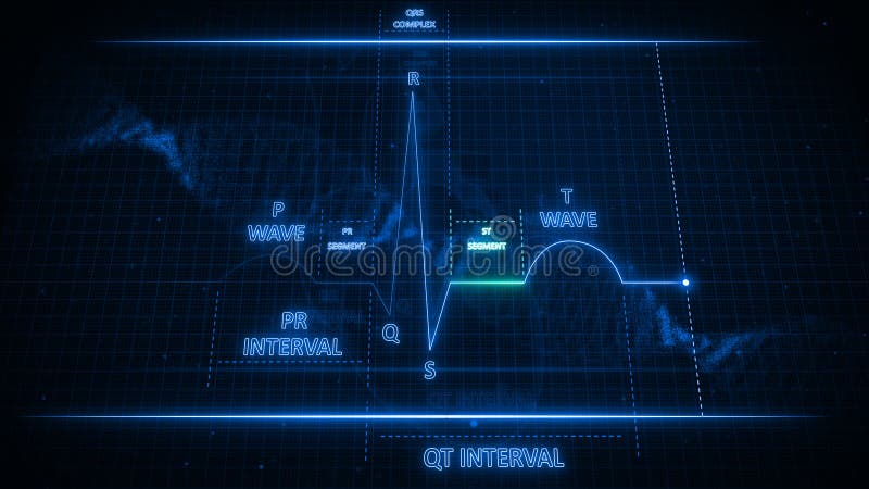 ST Segment from Electrocardiogram Wave or ECG or EKG Stock Illustration ...