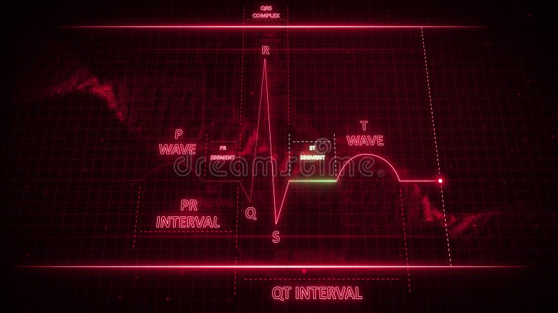 ST Segment from Electrocardiogram Wave or ECG or EKG Stock Illustration ...