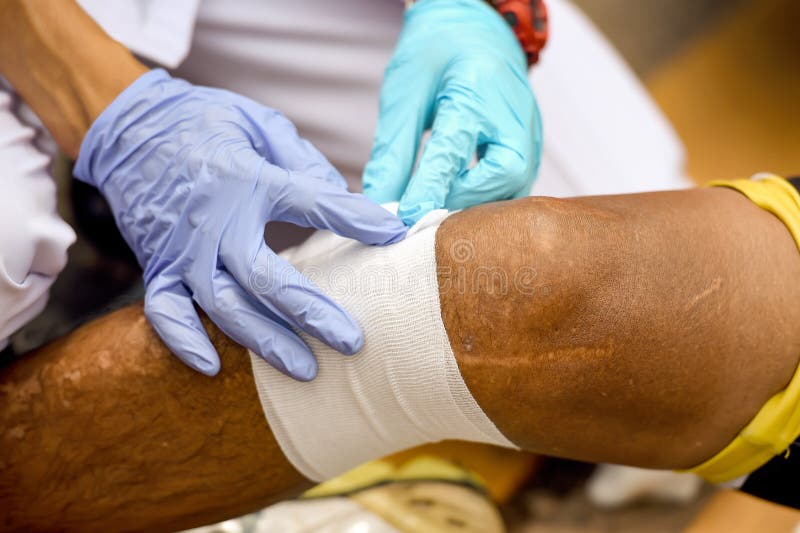 The Staff is Wrapping the Wound. To the Leg Wound after Sterilization ...