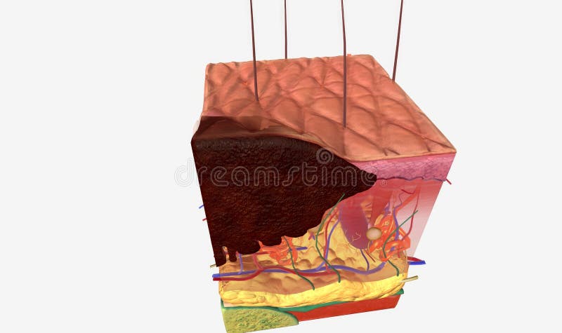 Cutaneous Nerve Stock Illustrations – 71 Cutaneous Nerve Stock ...