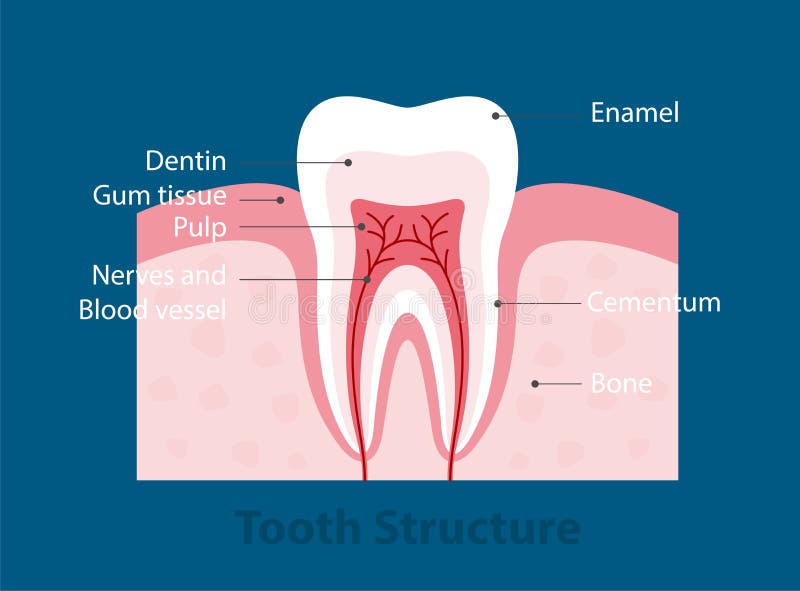 Tooth Decay Diagram