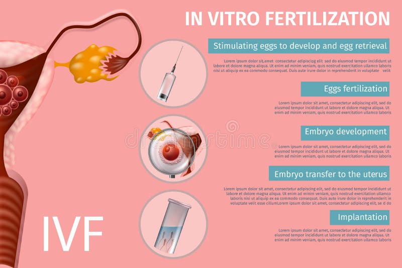 Ivf Banner Stock Illustrations – 261 Ivf Banner Stock Illustrations ...