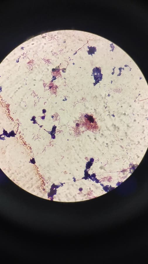 Stained Bacteria Seen through a Microscope Stock Photo - Image of ...